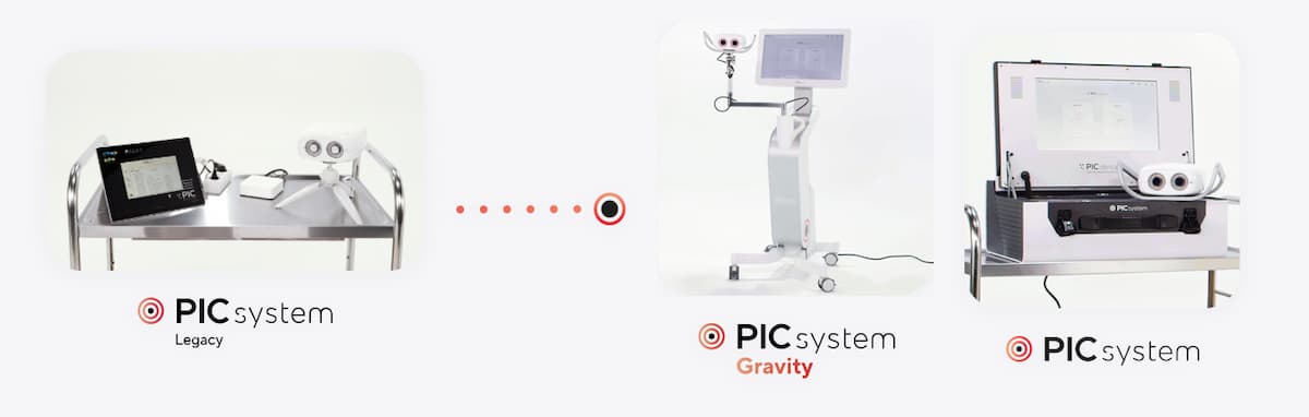 Accuracy of traditional open-tray impression, stereophotogrammetry, and ...